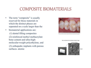 classification of biomaterials by vishnumenon.m | PPTX