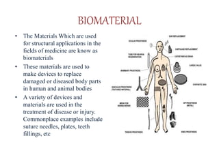 classification of biomaterials by vishnumenon.m | PPT