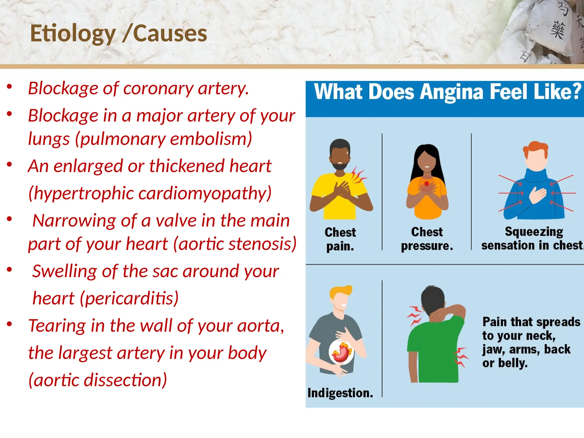 MONIKA (E-Content Angina Pectoris, 2024-25).pptx