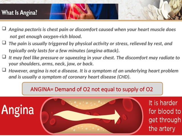 MONIKA (E-Content Angina Pectoris, 2024-25).pptx