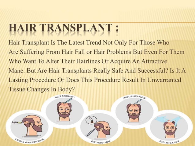 All About Hair Transplant | PPT