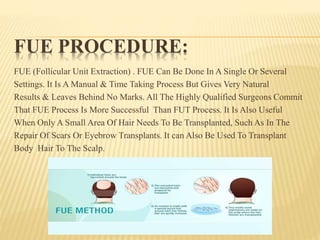 All About Hair Transplant | PPT