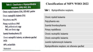 monika Myeloproliferative neoplasm1.pptx