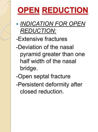 ORAL SURGERY( FRACTURE) | PPTX