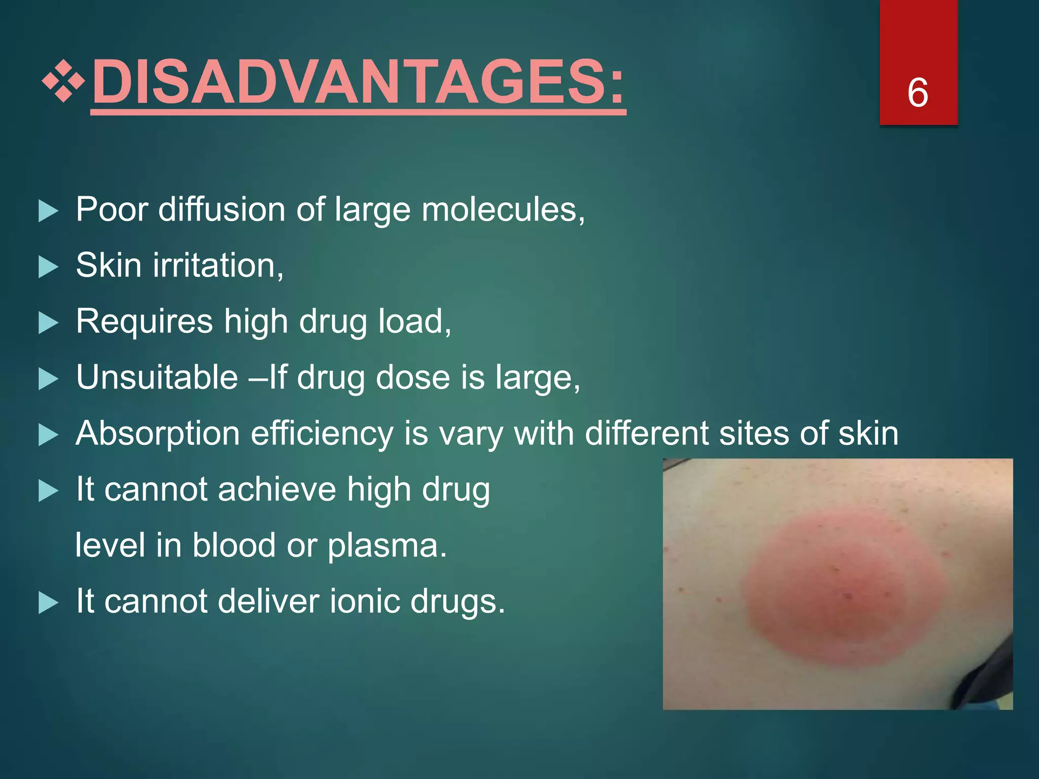 Transdermal drug delivery system | PPTX