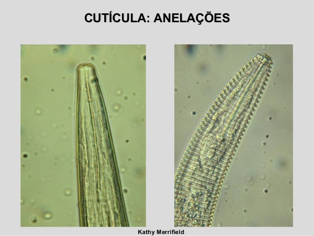 Nematoides de vida livre - Parte 1