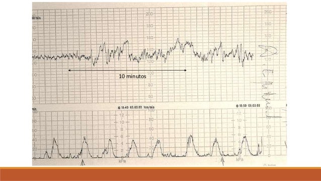 Monitoreo Fetal - 2016