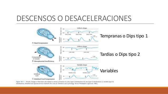 Monitoreo Fetal - 2016
