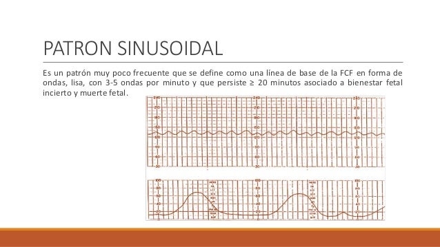 Monitoreo Fetal - 2016