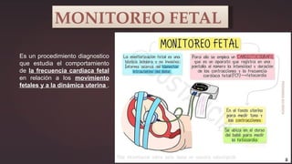 El monitoreo fetal es una herramienta esencial en la obstetricia ...