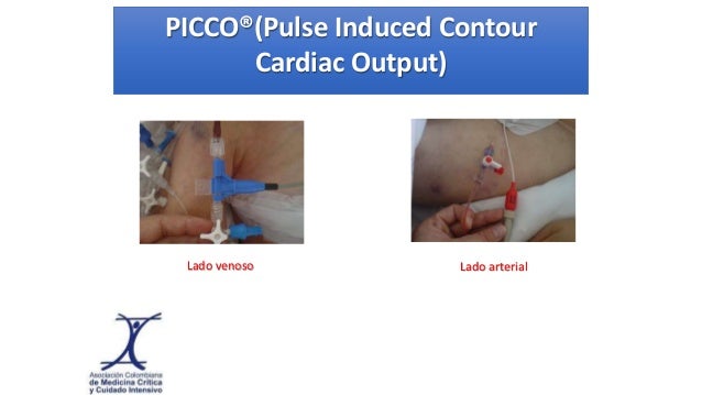 Haemodynamic monitoring in the critical care pregnant patient