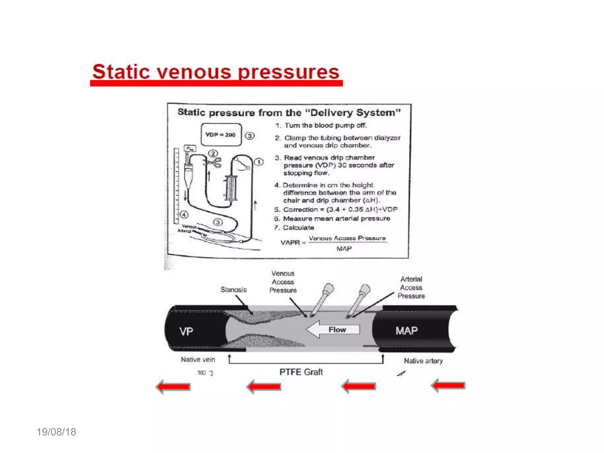 Monitoring and surveillance_of_vascular_access | PPT