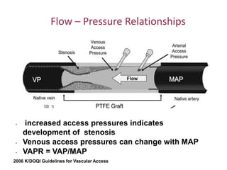 Monitoring and surveillance_of_vascular_access | PPT