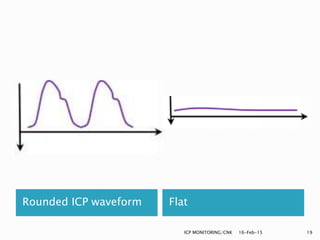 Monitoring and treatment of increased intracranial pressure cnk | PPT