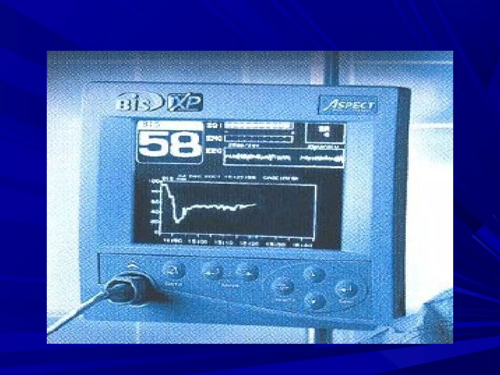 Monitoring depth of anaesthesia | PPT