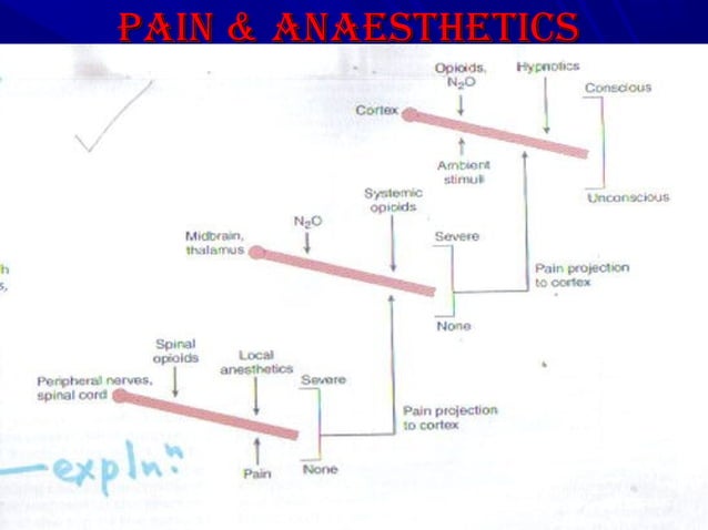 Monitoring depth of anaesthesia | PPT | Surgery | Medical Health
