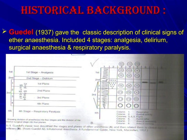 Monitoring depth of anaesthesia | PPT | Surgery | Medical Health