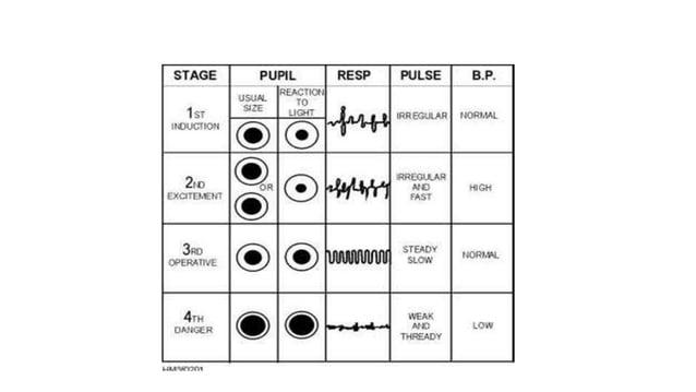 Monitoring depth of anesthesia | PPTX