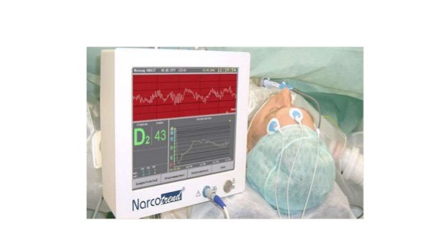 Monitoring depth of anesthesia