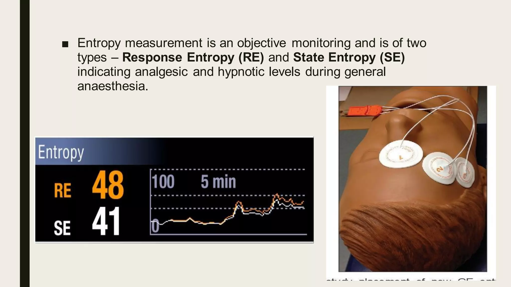 Monitoring Depth of Anaesthesia | PDF