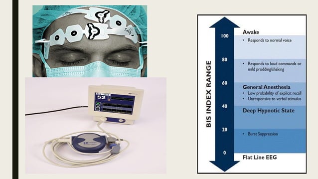 Monitoring Depth of Anaesthesia | PDF | Brain and Nervous System ...