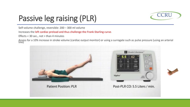 Monitoring Fluid Responsiveness in ICU | PPTX
