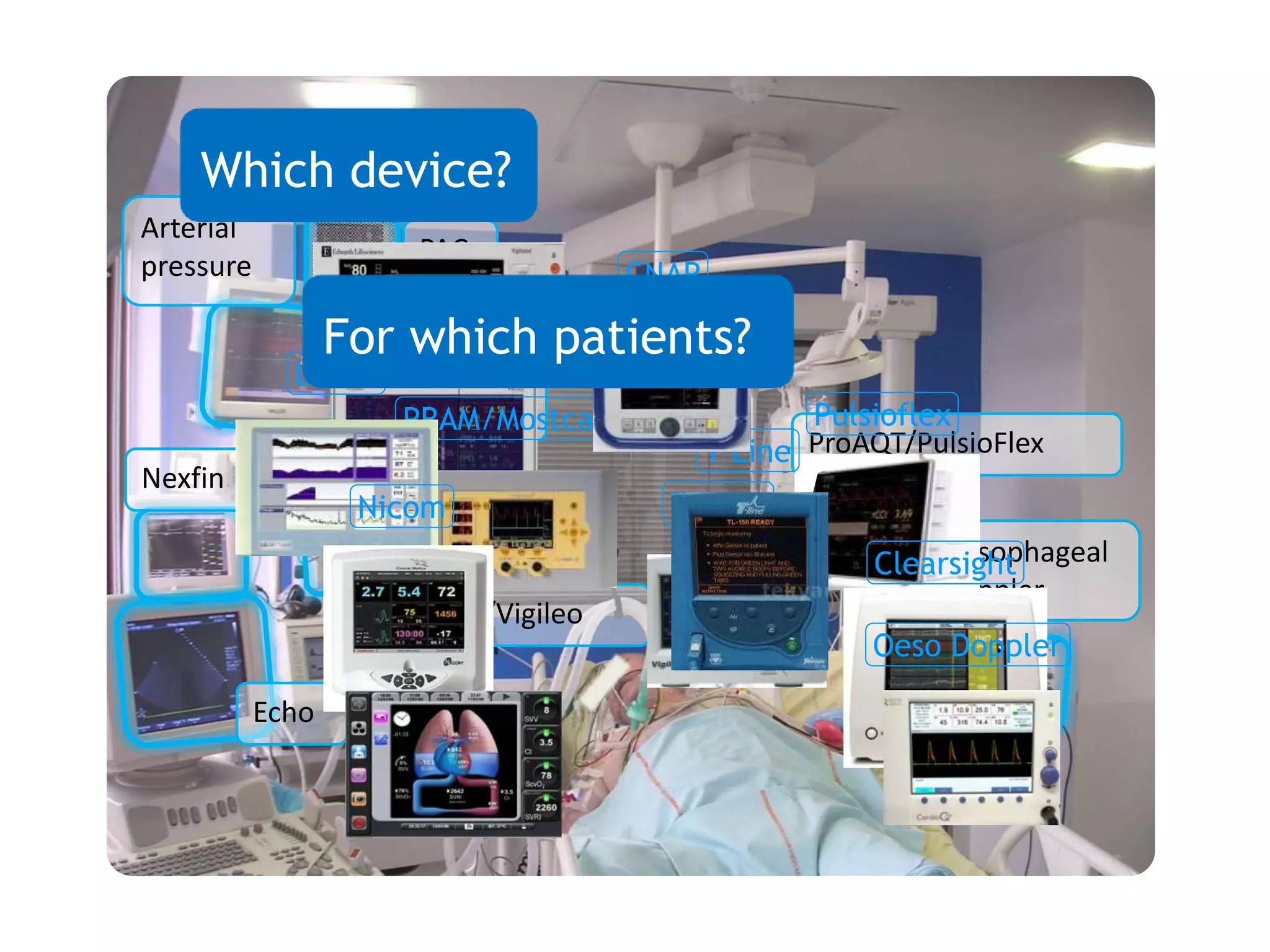 Which cardiac output monitoring? | PPTX