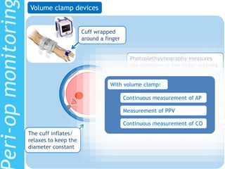 Which cardiac output monitoring? | PPTX