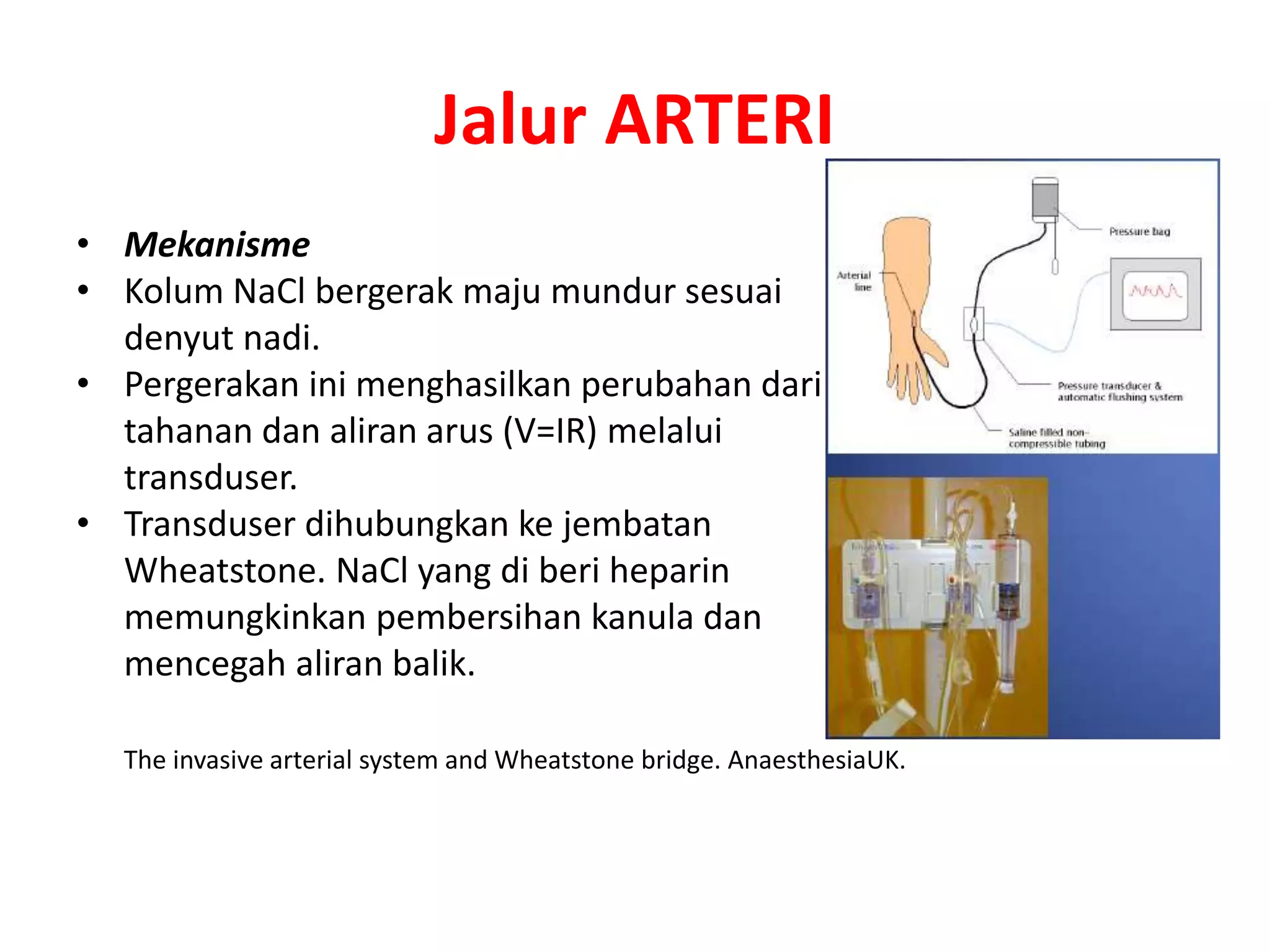 Monitoring hemodinamik invasif | PPTX