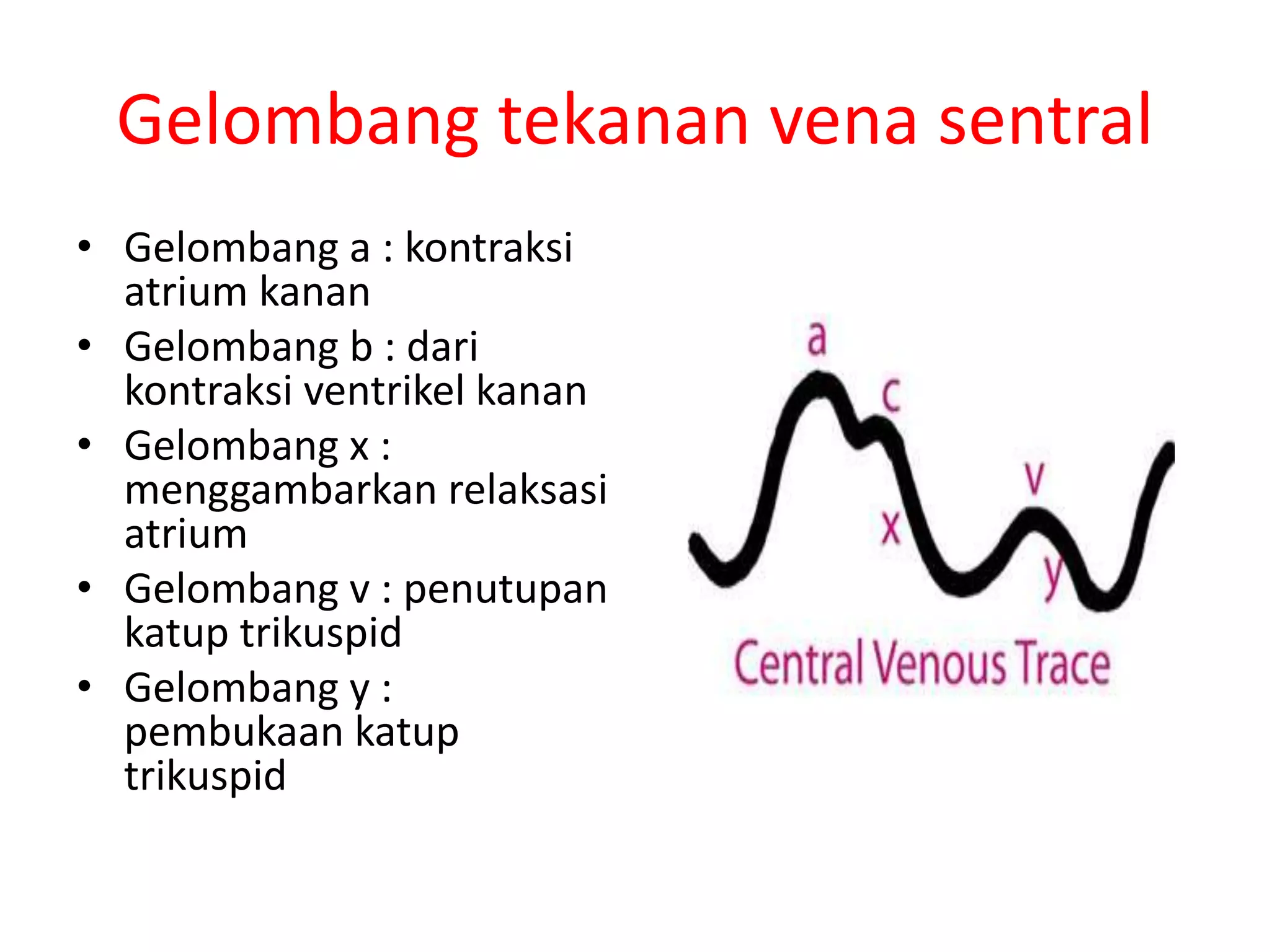 Monitoring hemodinamik invasif | PPTX