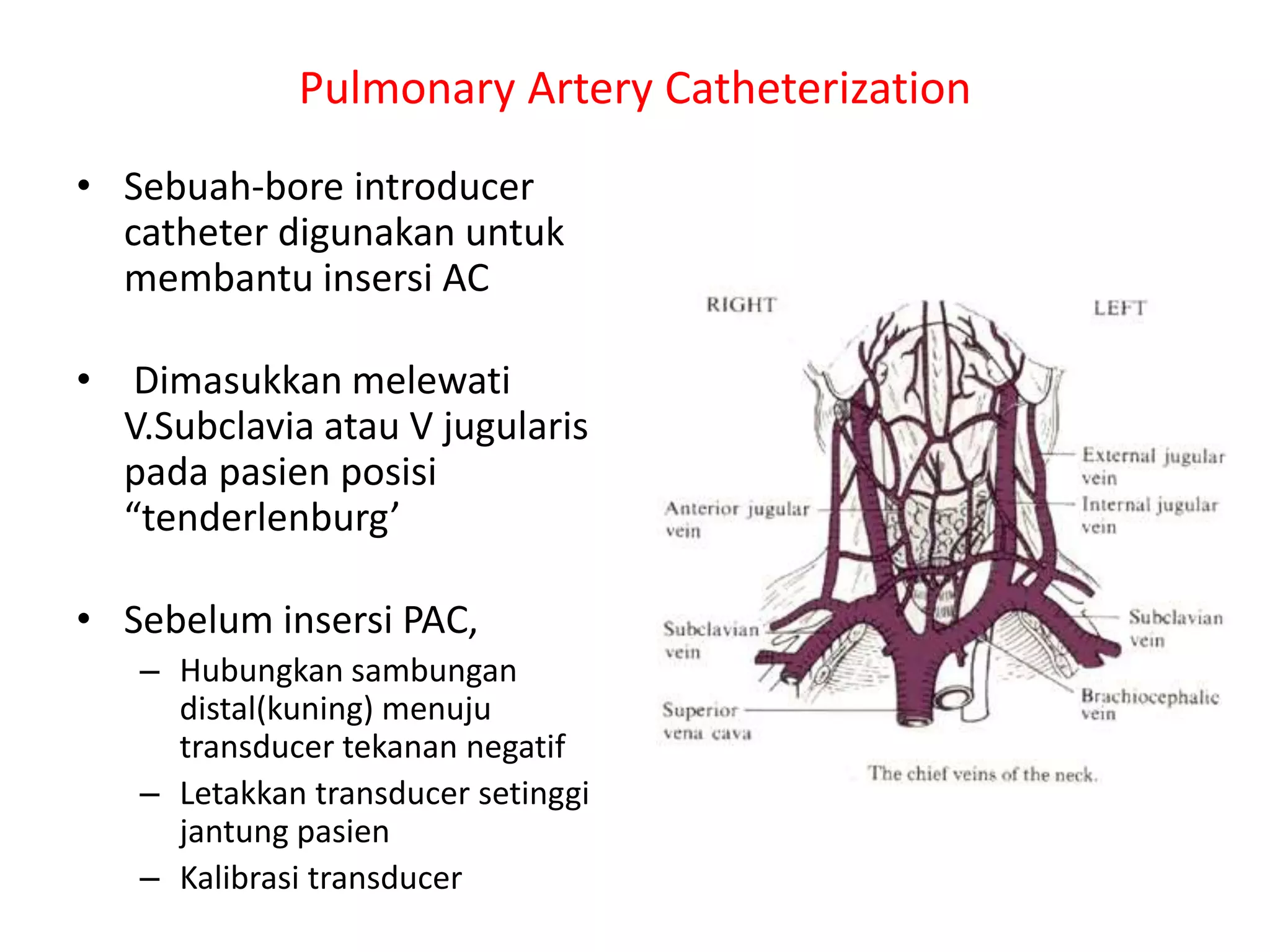 Monitoring hemodinamik invasif | PPTX