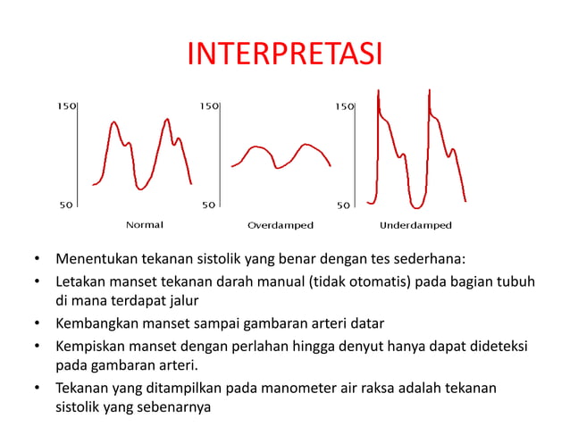 Monitoring hemodinamik invasif | PPTX