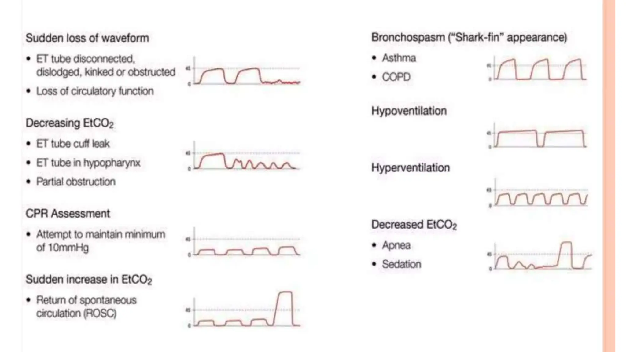 BASIC MONITORING IN ANAESTHESIA PRESENTATION.pptx