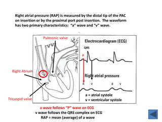 Monitoring in cardiac ananesthesia | PPTX