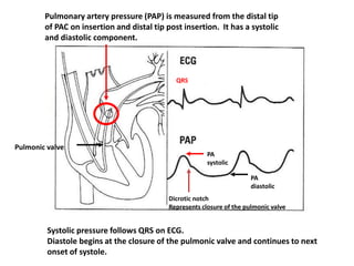 Monitoring in cardiac ananesthesia | PPTX