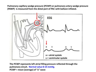 Monitoring in cardiac ananesthesia | PPTX