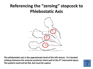 Monitoring in cardiac ananesthesia | PPTX