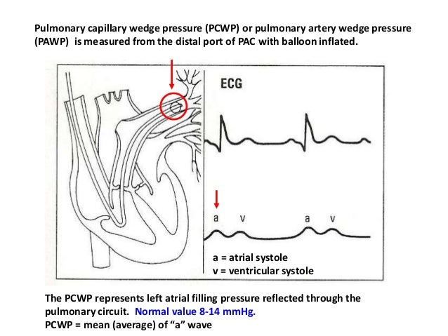 Monitoring in cardiac ananesthesia