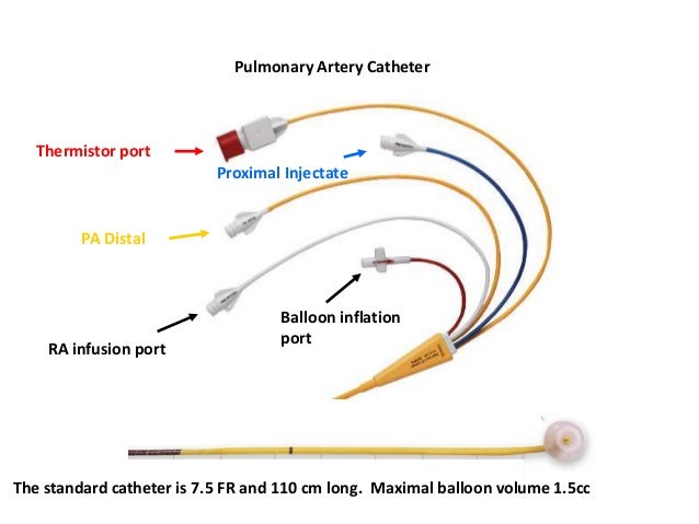 Monitoring in cardiac ananesthesia