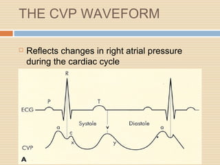 Monitoring in ICU | PPT