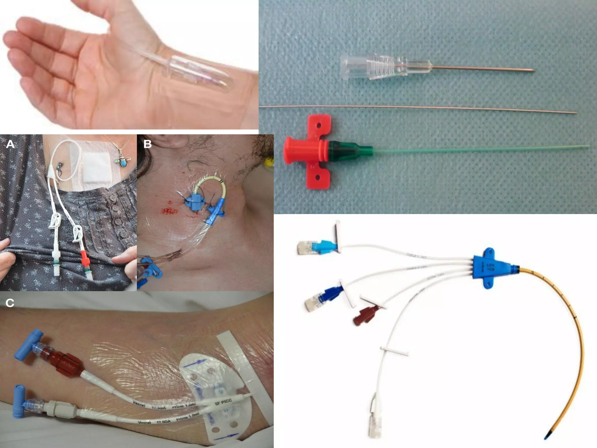 Monitoring system in icu | PDF