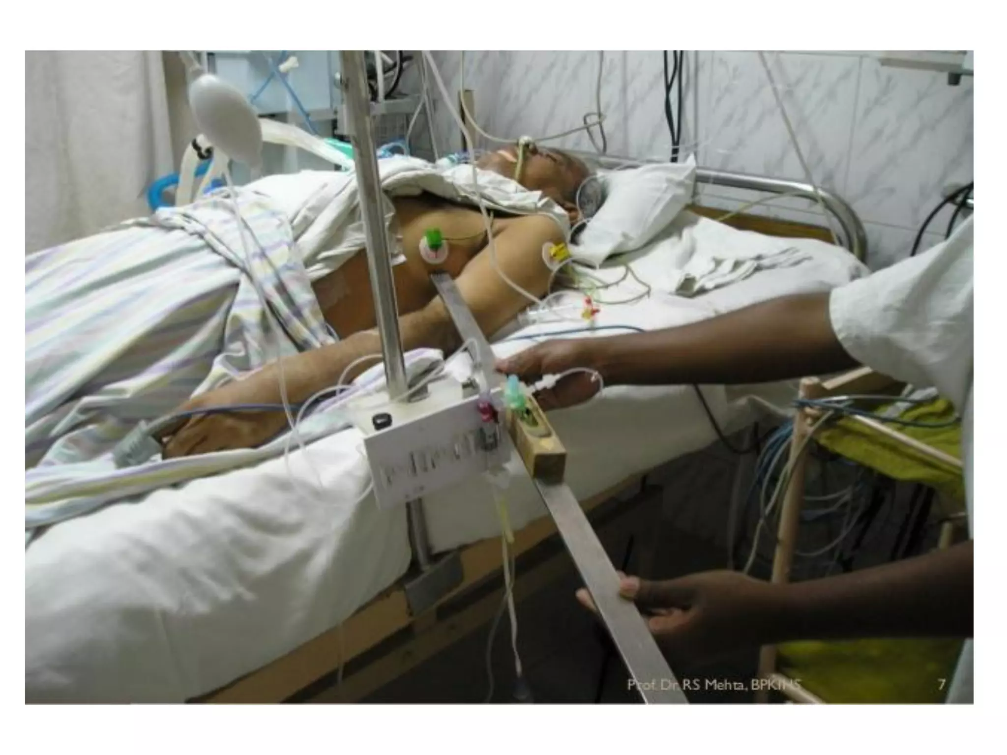 Monitoring system in icu | PDF