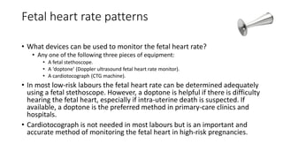 Monitoring the condition of the fetus during the first stage of labour.pdf
