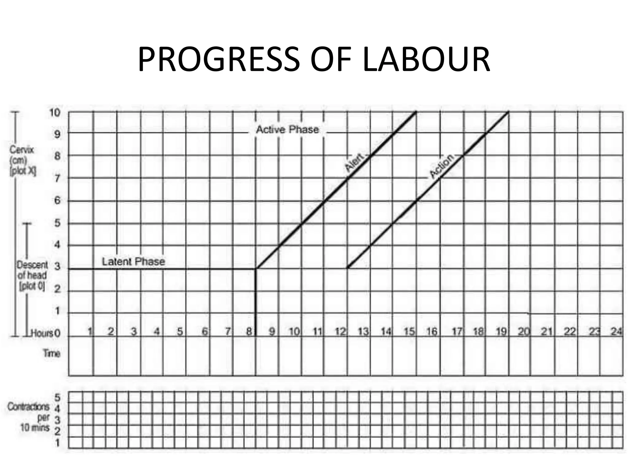 MONITORING THE PROGRESS OF LABOUR.pptx