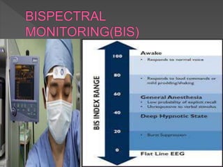 Monitoring under anaesthesia-brief description for undergrads. | PPTX