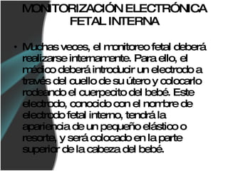 Monitorizacion fetal | PPT