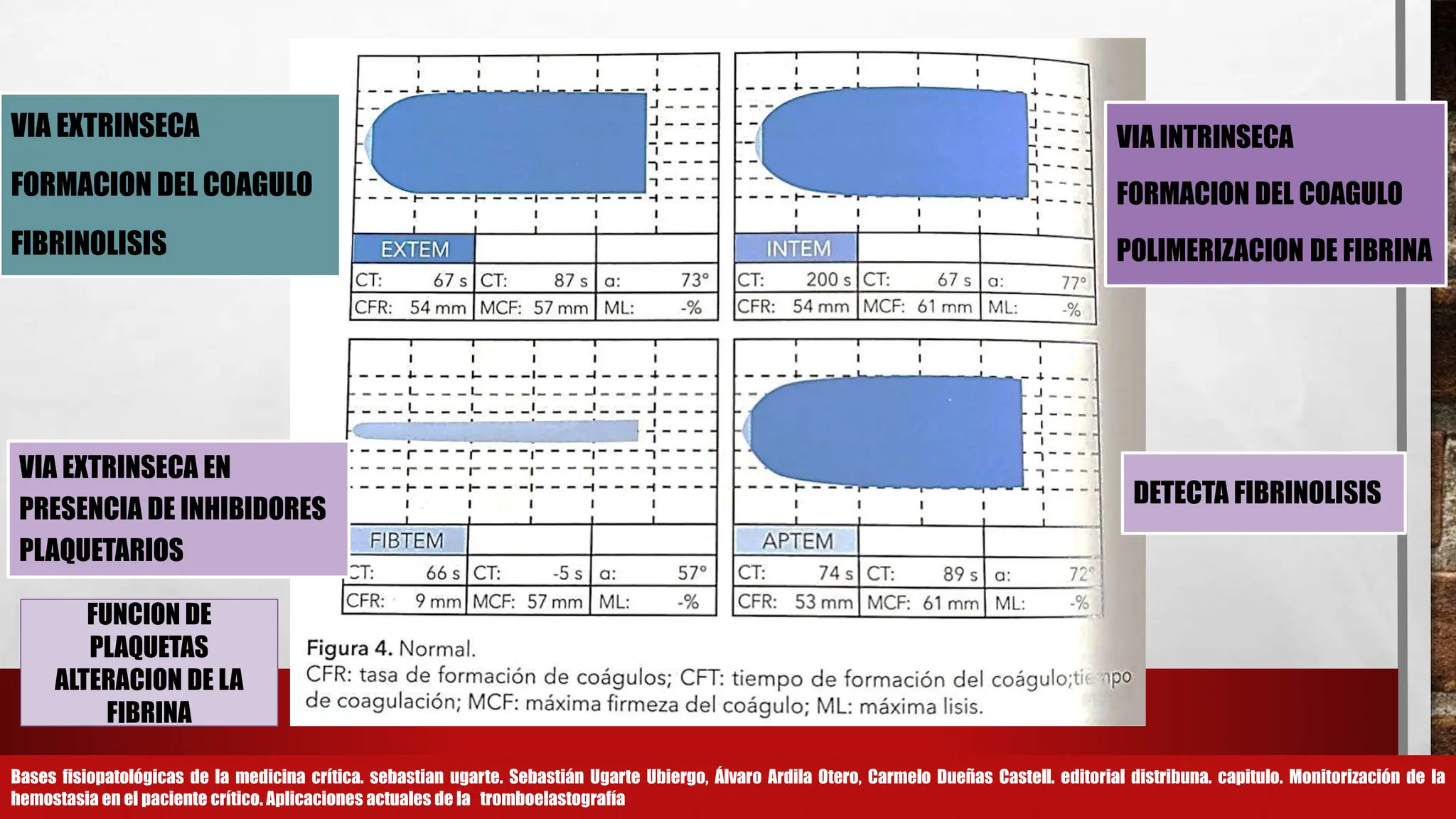 MONITORIZACION HEMOSTASIA TEG Y ROTEM.pptx
