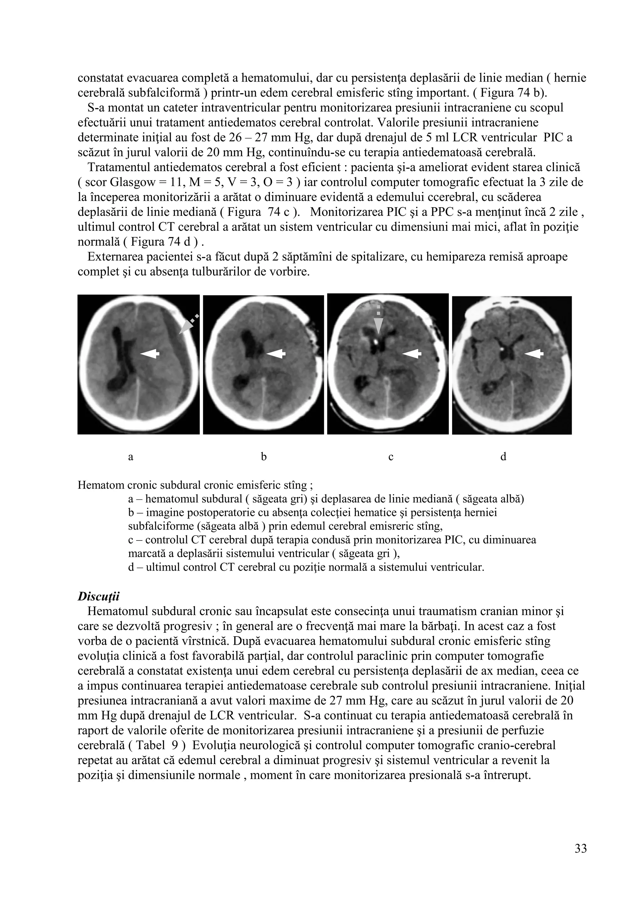 Monitorizarea presiunii intracraniene | PDF
