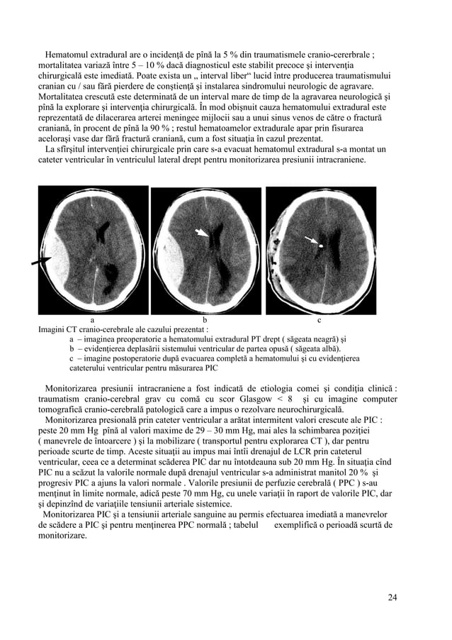 Monitorizarea presiunii intracraniene | PDF