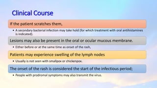 Monkeypox Virus | PPTX